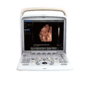 Chison Q5 Ultrasound – DJ Medquip